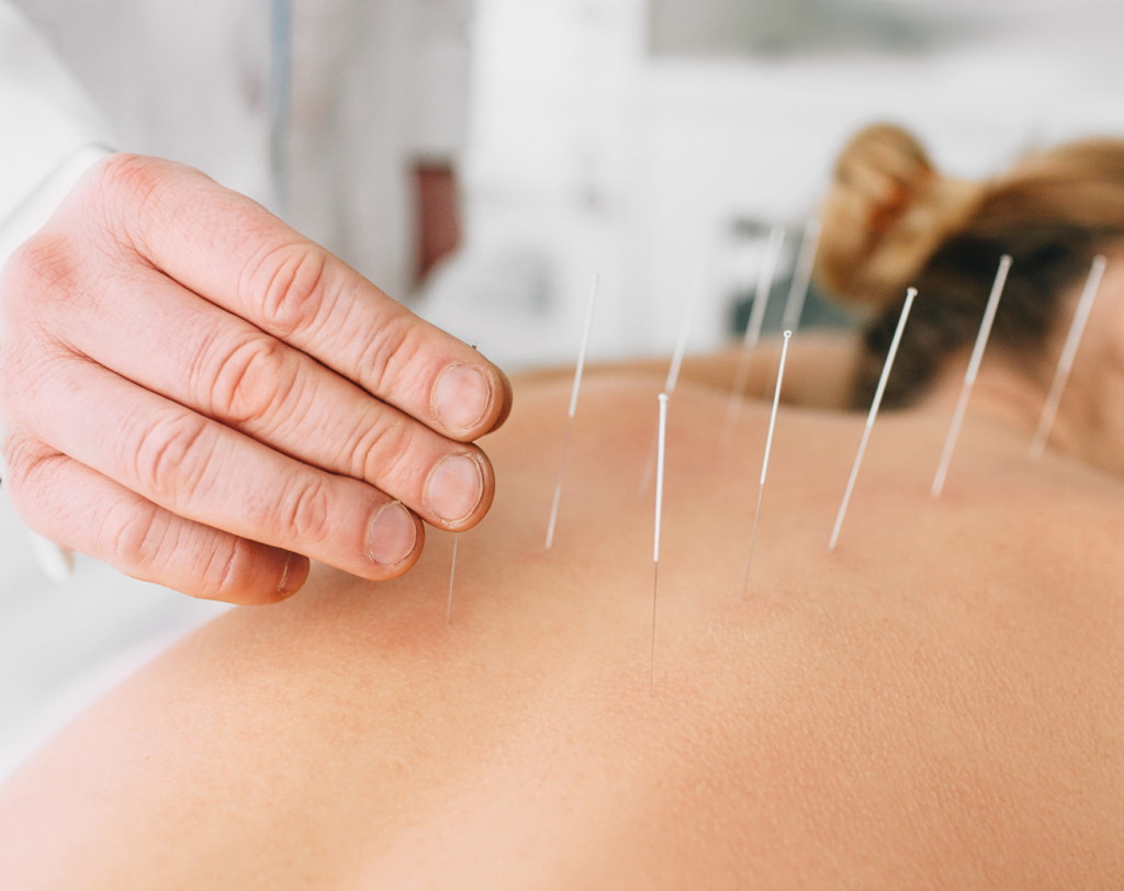 Acupuncture for Autoimmune Disease | Alene Brennan